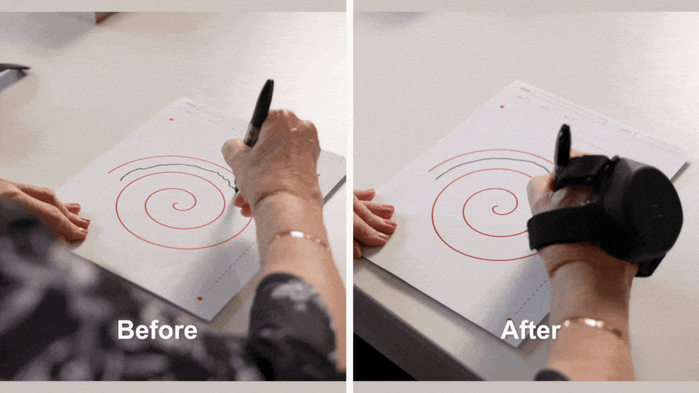 Essential Tremor Glove | Hand Tremor Device | Steadiwear Inc